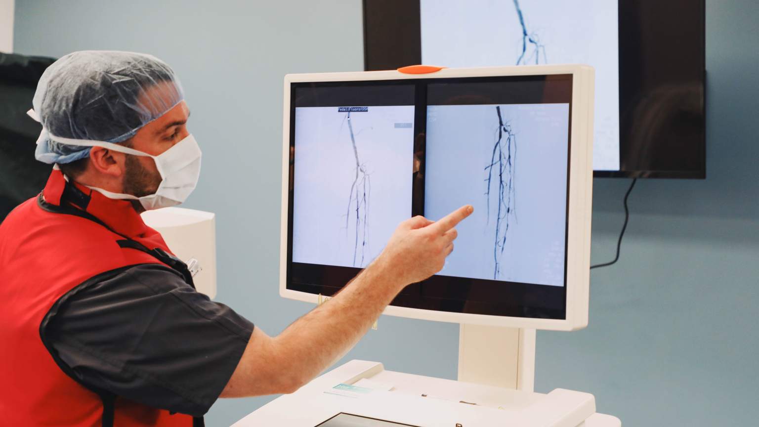 Overview - Access Care Vascular - Buffalo, NY