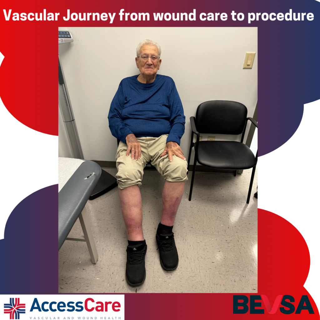 Vascular journey from wound care to procedure - Access Care Vascular ...
